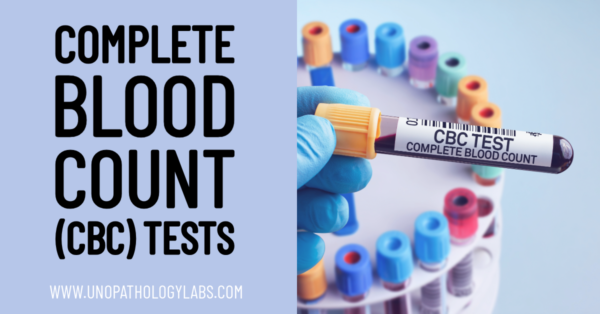 CBC Test (Complete Blood Count) in Mohali | Chandigarh | Panchkula- Uno ...